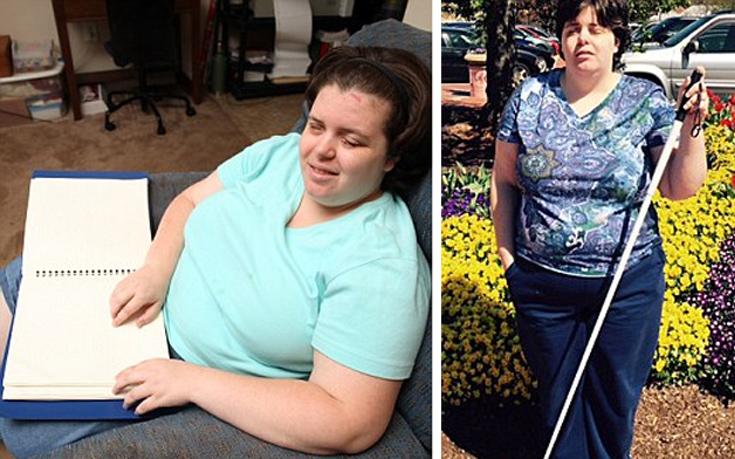 Jewel Shuping: Η γυναίκα που είχε όνειρο ζωής να… τυφλωθεί! [φωτό ...