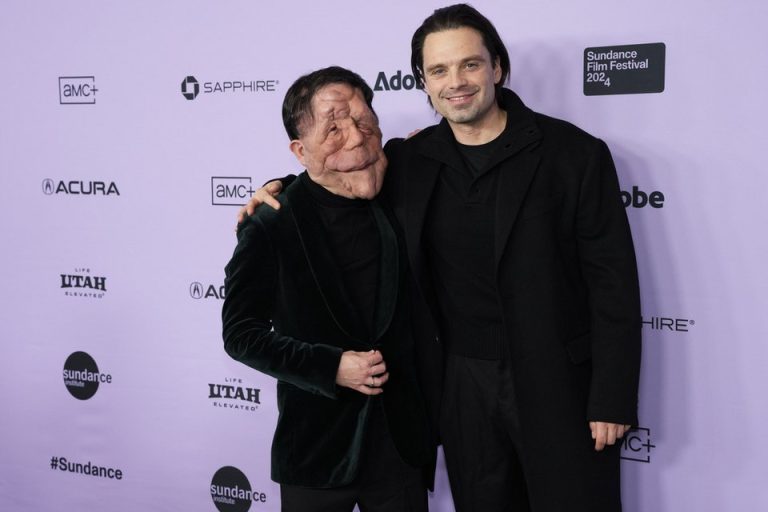 Ποιος είναι ο ηθοποιός της ταινίας «A Different Man» – Η ιστορία «πίσω ...