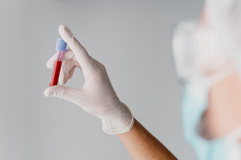 ΗΠΑ: Ερευνητές ανέπτυξαν οικονομικά προσιτή εξέταση αίματος που ...